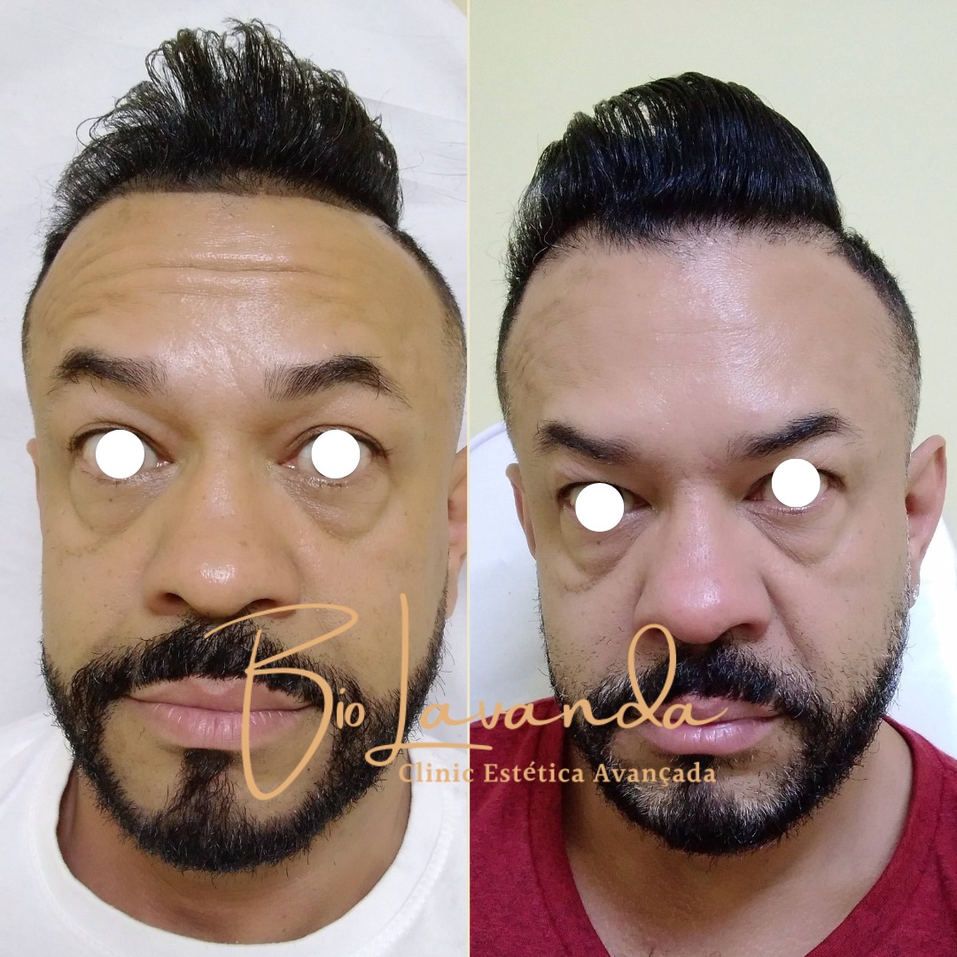 Bio Lavanda Clinic – Bio Lavanda Clinic